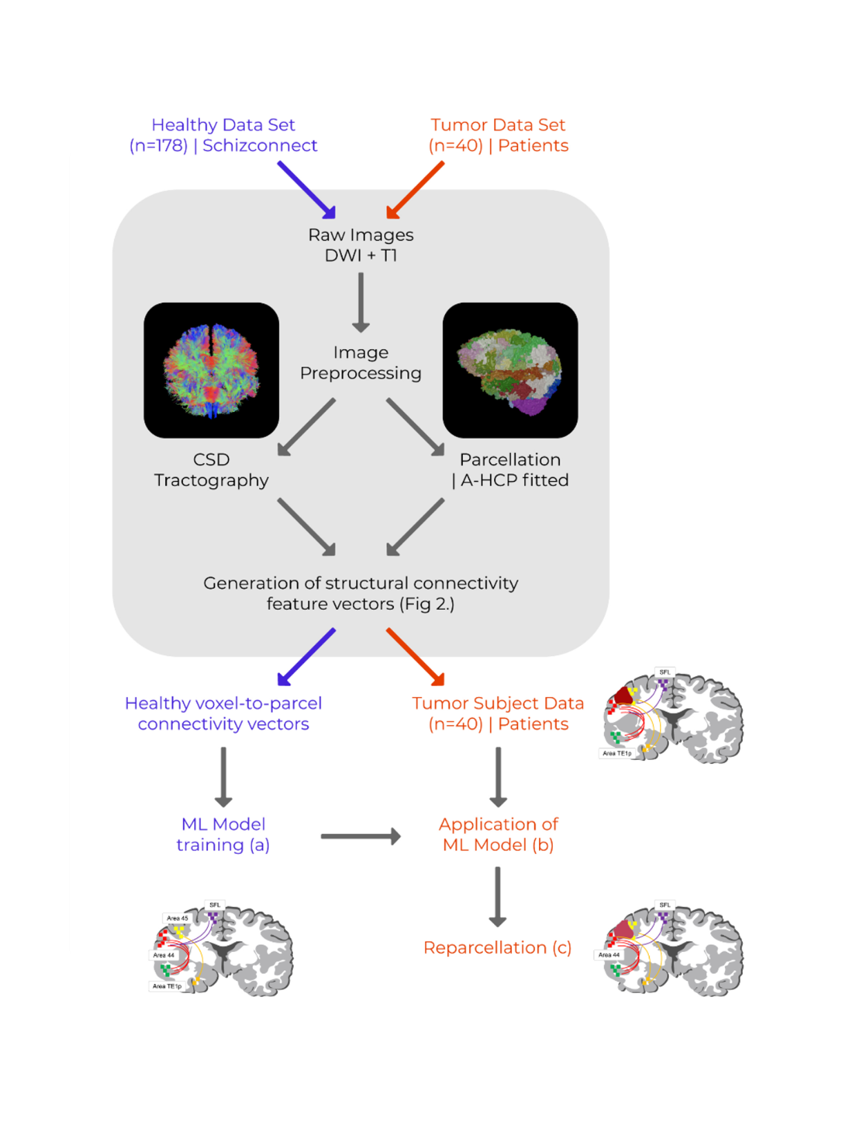 How Personalized Mapping of Brain Networks aids Neurosurgery